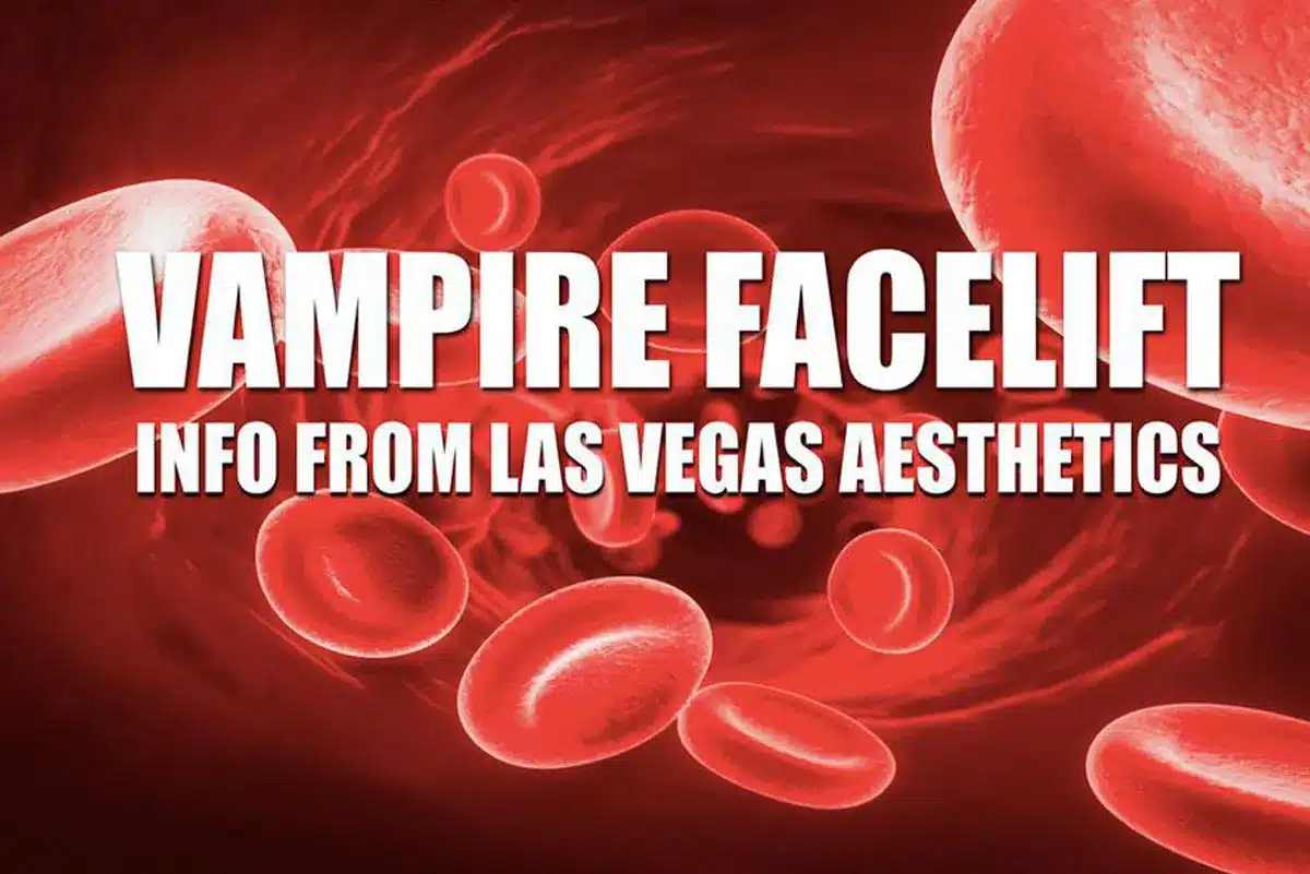 What is a Vampire FaceLift treatment anyway? | Las Vegas Aesthetics